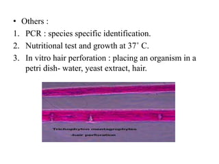 Dermatophytes | PPTX