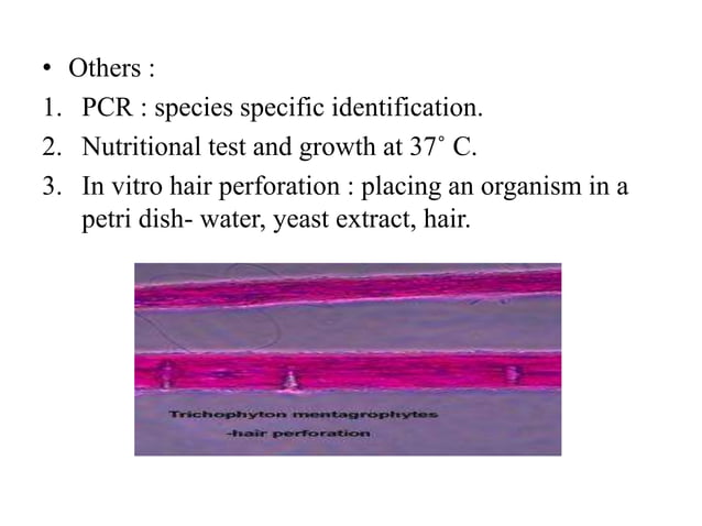Dermatophytes | PPTX | Foot Health | Diseases and Conditions