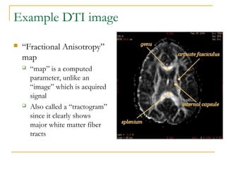 DTI lecture 100710 | PPT