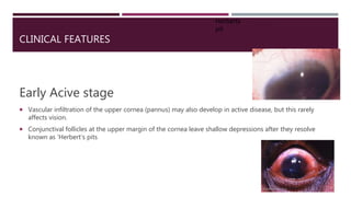 chlamydia and EYE | PPTX