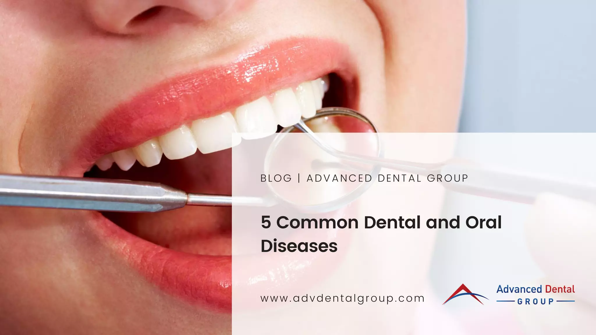 5 Common Dental And Oral Diseases Ppt