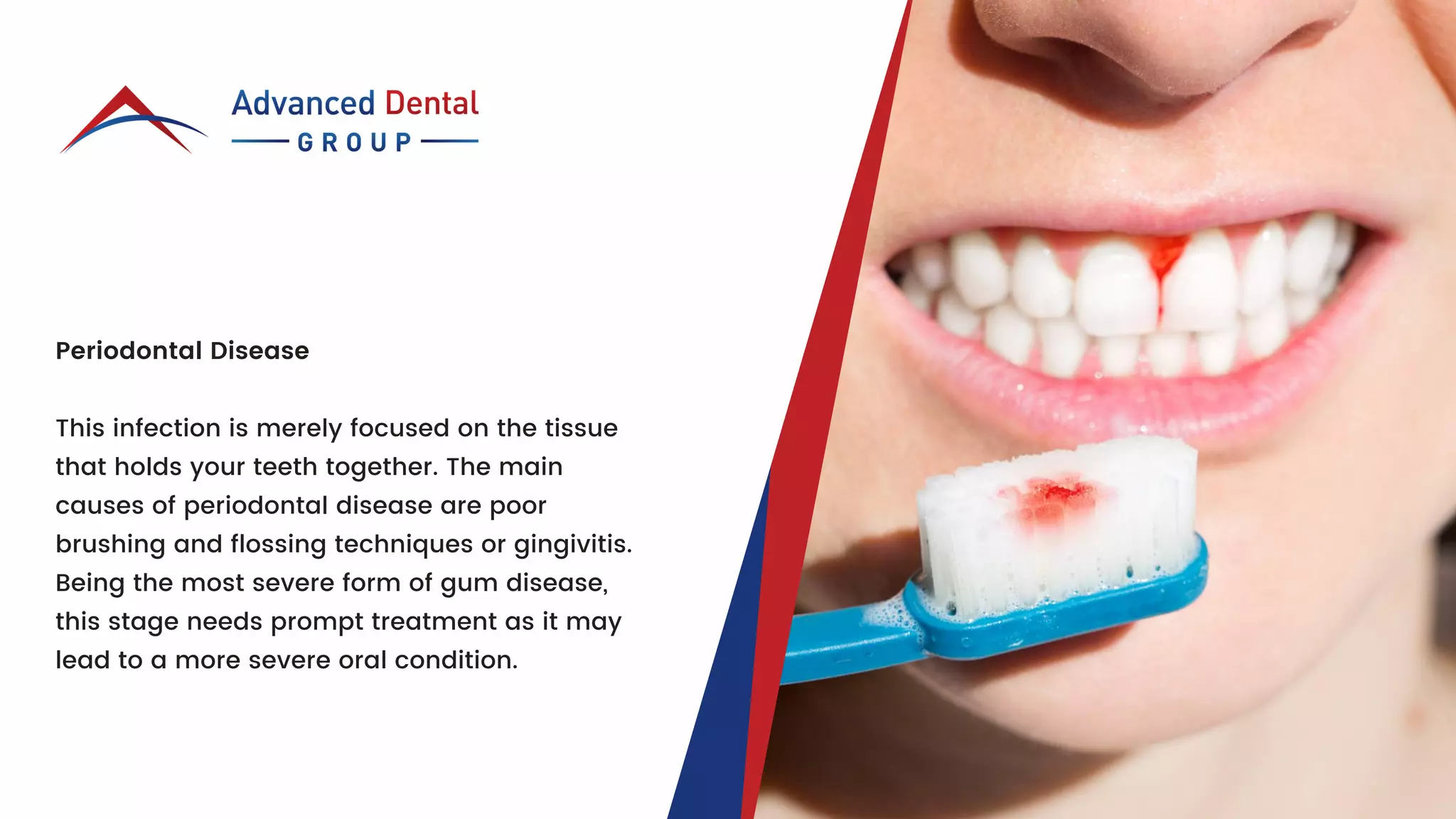 5 Common Dental and Oral Diseases | PDF