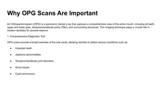 5 Common Dental Issues Detected with an OPG Scan.pptx