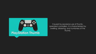 5 common gaming injuries | PDF | Death, Injury, or Military Conflict ...