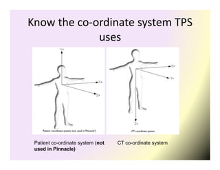 Radiotherapy Treatment Simulation | PPT