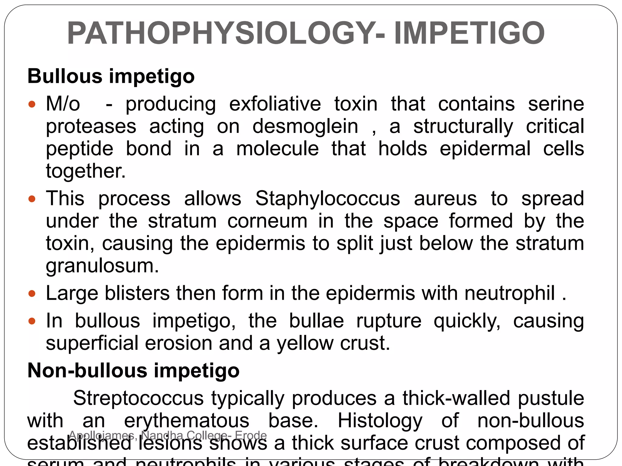 IMPETIGO- SKIN DISORDER-APOLLOJAMES | PPTX