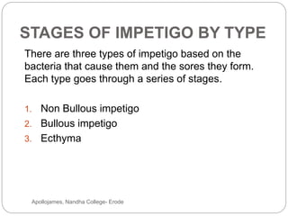 IMPETIGO- SKIN DISORDER-APOLLOJAMES | PPTX