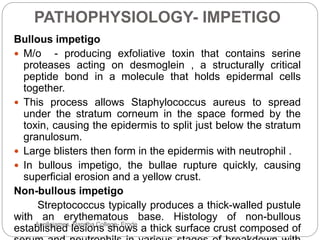 Bullous Impetigo Histology