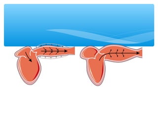 Presentasi AED | PPT