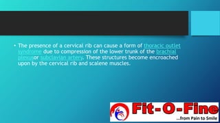 Cervical Rib | PPTX