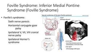 Differential Diagnosis in Lateral Rectus Palsy | PPTX
