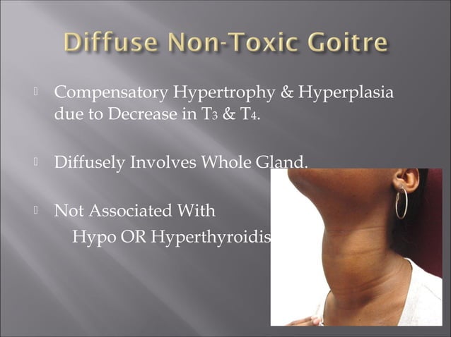 diffuse toxic & endemic goiter | PPT | Thyroid Disorders | Endocrine ...
