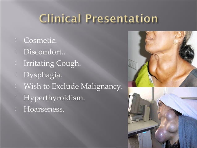 diffuse toxic & endemic goiter | PPT | Thyroid Disorders | Endocrine ...