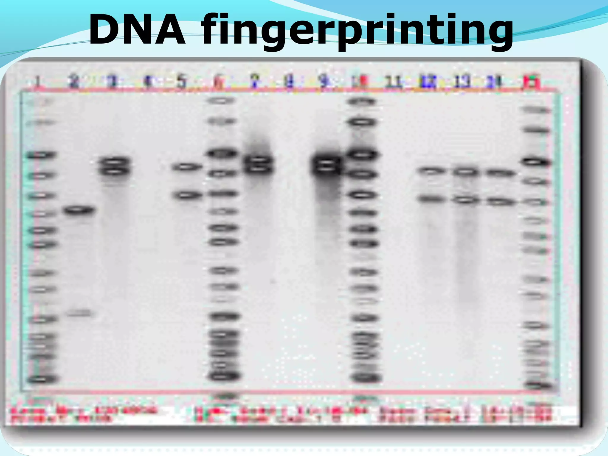 dna fingerprinting powerpoint | PPT
