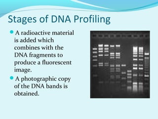 dna fingerprinting powerpoint | PPT