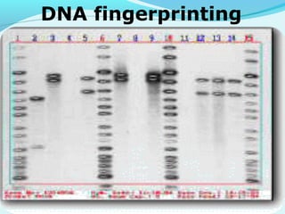 dna fingerprinting powerpoint | PPT