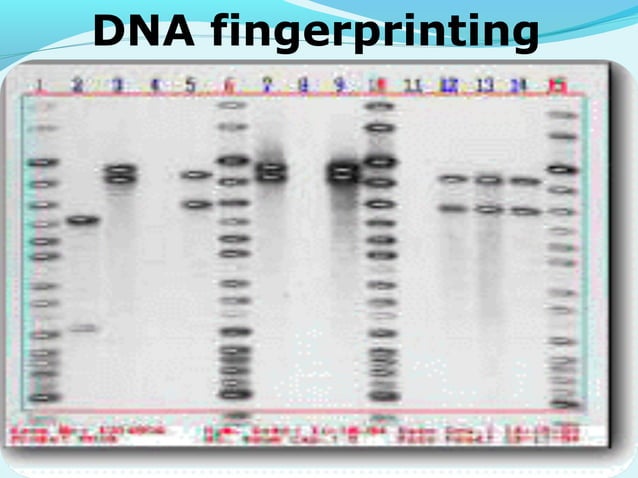 dna fingerprinting powerpoint | PPT | Genetics | Science