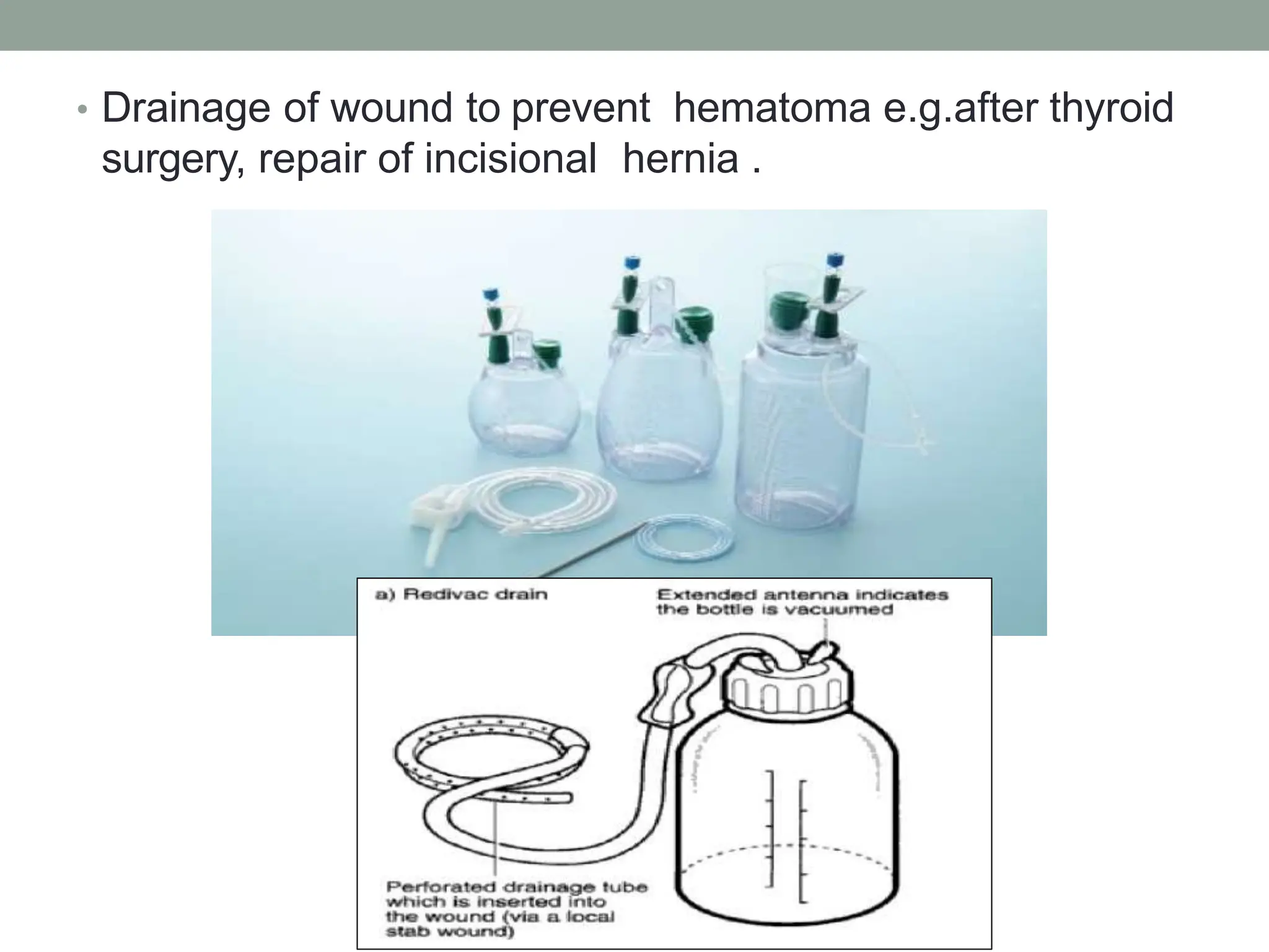 Drains & tubes used in surgery.pptx