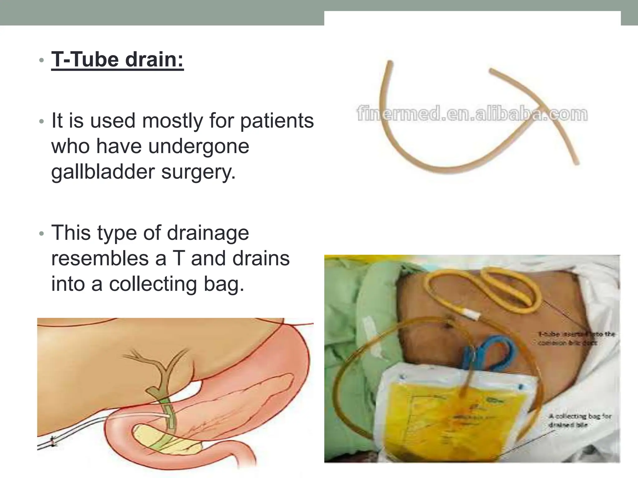 Drains & tubes used in surgery.pptx