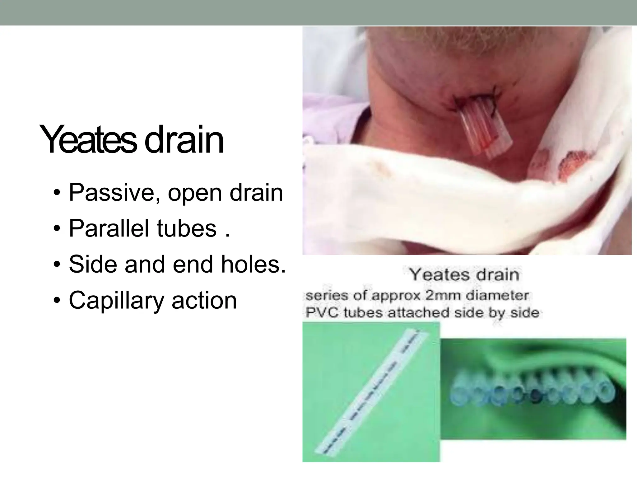Drains & tubes used in surgery.pptx