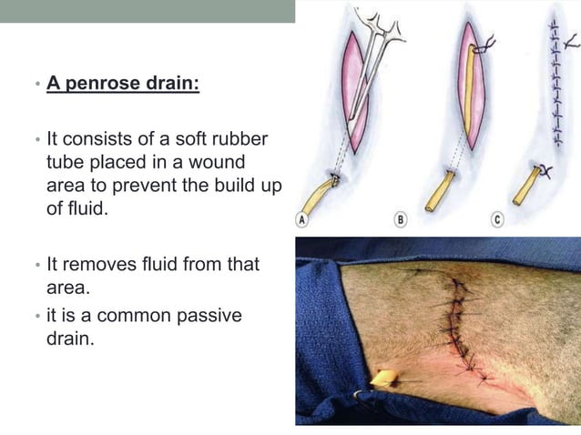 Drains & tubes used in surgery.pptx | Death, Injury, or Military ...