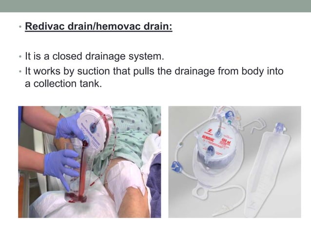 Drains & tubes used in surgery.pptx | Death, Injury, or Military ...