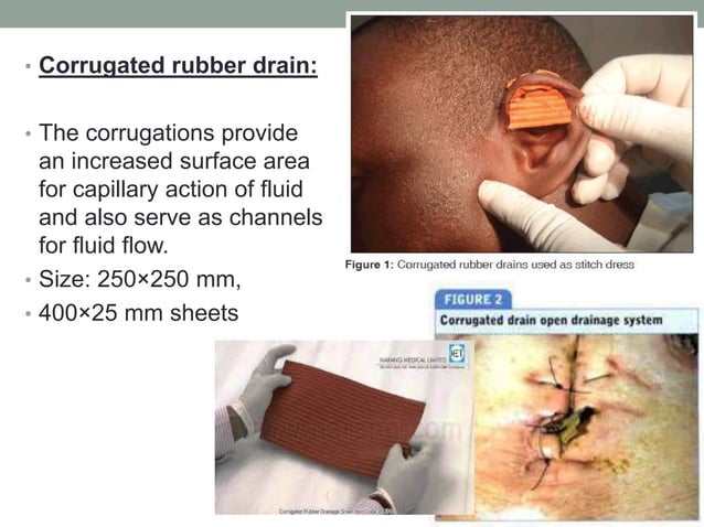 Drains & tubes used in surgery.pptx | Death, Injury, or Military ...