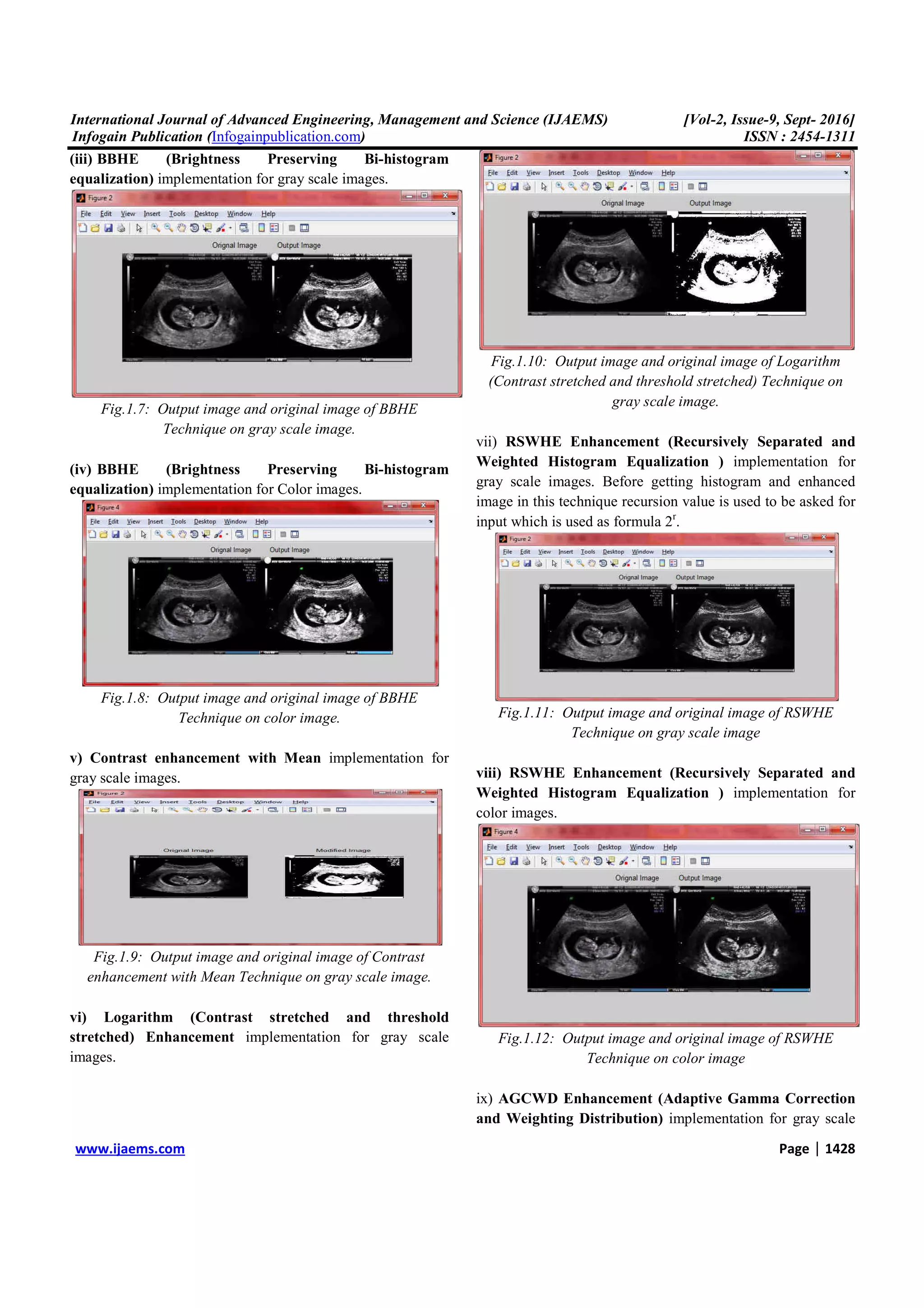 Enhancement of Medical Images using Histogram Based Hybrid Technique | PDF