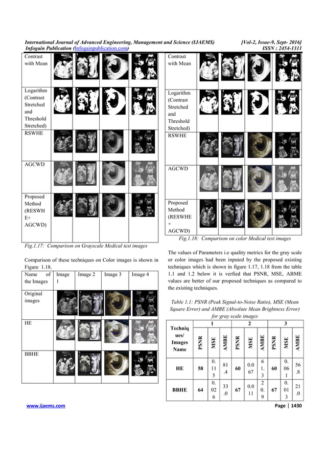 Enhancement of Medical Images using Histogram Based Hybrid Technique | PDF