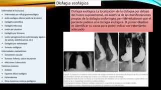 5 esofago [Autoguardado].pptx