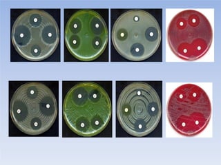 5 διαδικασίες προσαρμογής στο eucast | PDF