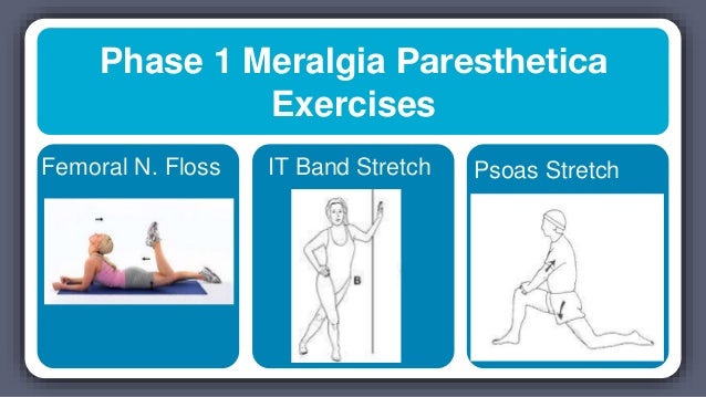 5 Exercises for Meralgia Parastetica