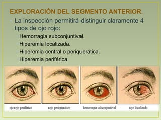 5 expo sindrome ojo rojo | PPTX