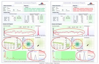 Explaining HRV using the Meridian DPA | PPT