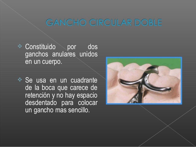 5 Ganchos De Protesis Parcial Removible