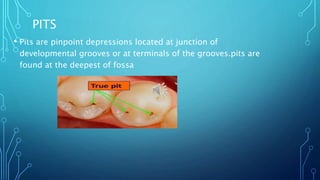 ANATOMICAL_LANDMARKS_OF_TEETH.pptx