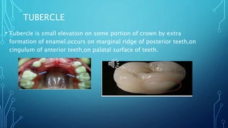 ANATOMICAL_LANDMARKS_OF_TEETH.pptx