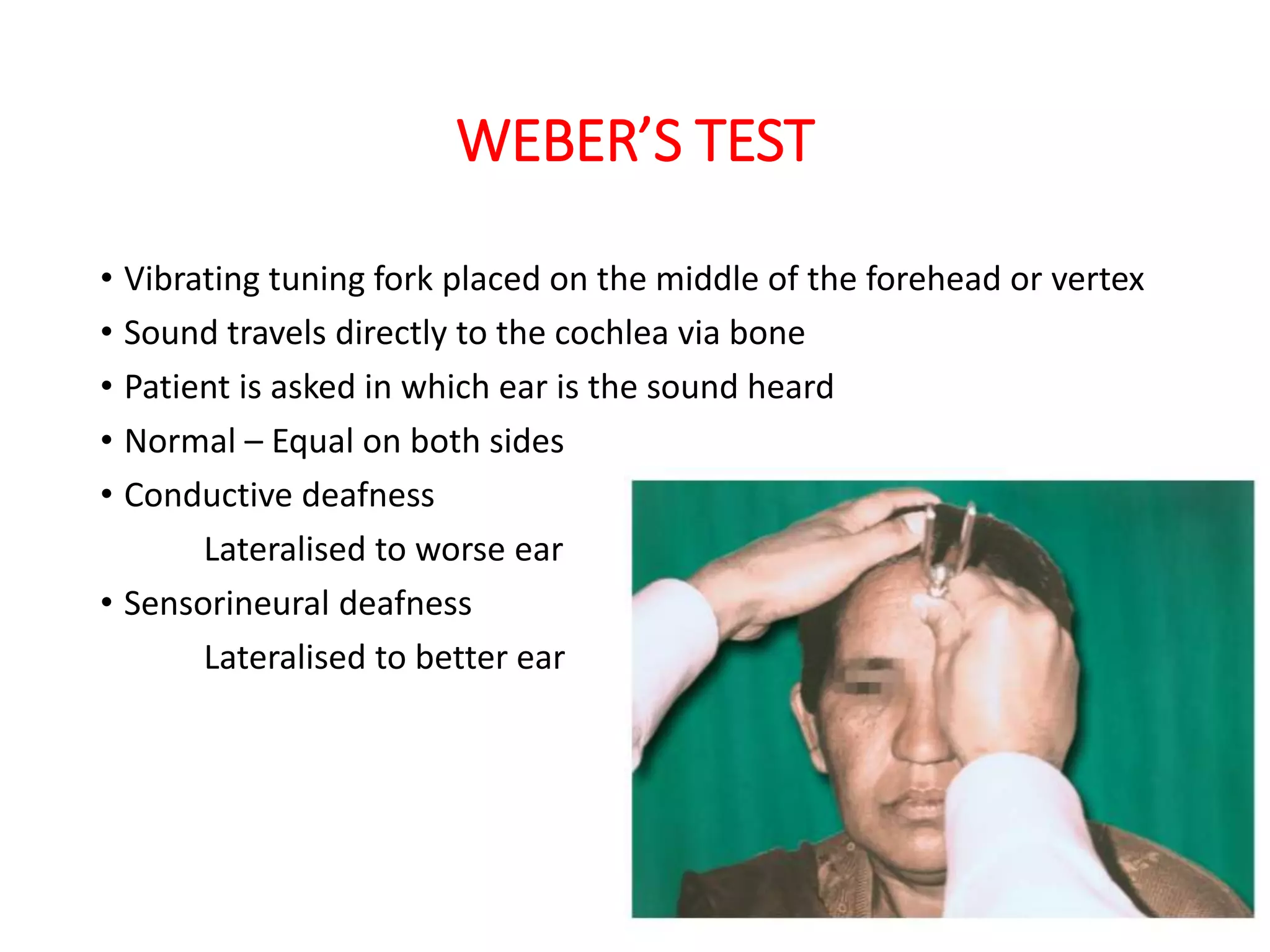 FUNCTIONAL ASSESSMENT OF HEARING & VESTIBULAR FUNCTION TESTS | PPTX