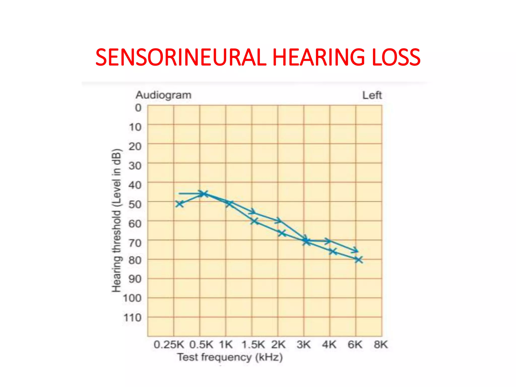 FUNCTIONAL ASSESSMENT OF HEARING & VESTIBULAR FUNCTION TESTS | PPTX
