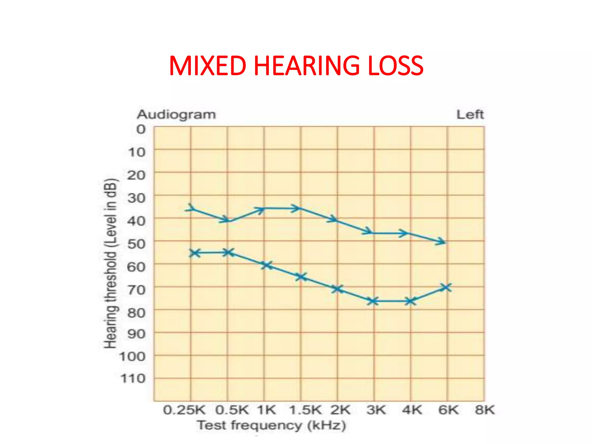 FUNCTIONAL ASSESSMENT OF HEARING & VESTIBULAR FUNCTION TESTS | PPTX ...