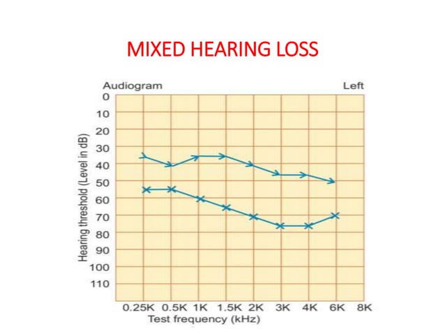 FUNCTIONAL ASSESSMENT OF HEARING & VESTIBULAR FUNCTION TESTS | PPTX ...