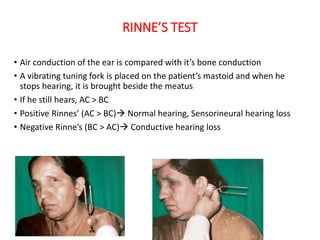 FUNCTIONAL ASSESSMENT OF HEARING & VESTIBULAR FUNCTION TESTS | PPT