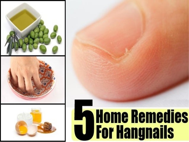 5 Home Remedies For Hangnails