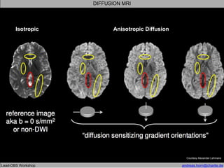 Structural Connectomics dMRI | PPT
