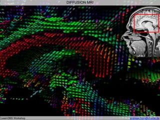 Structural Connectomics dMRI | PPTX
