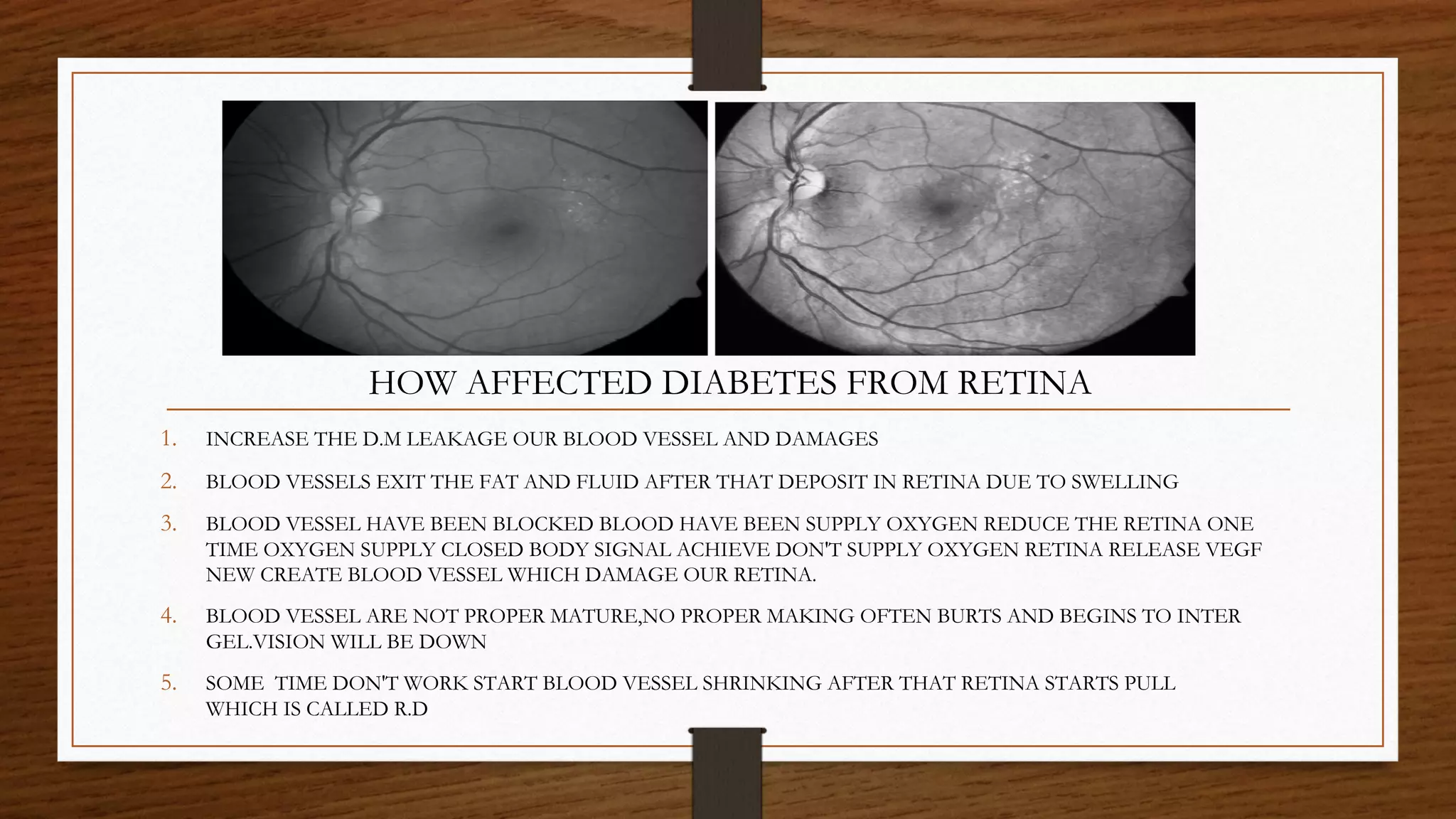 Diabetic ratinopathy | PPT