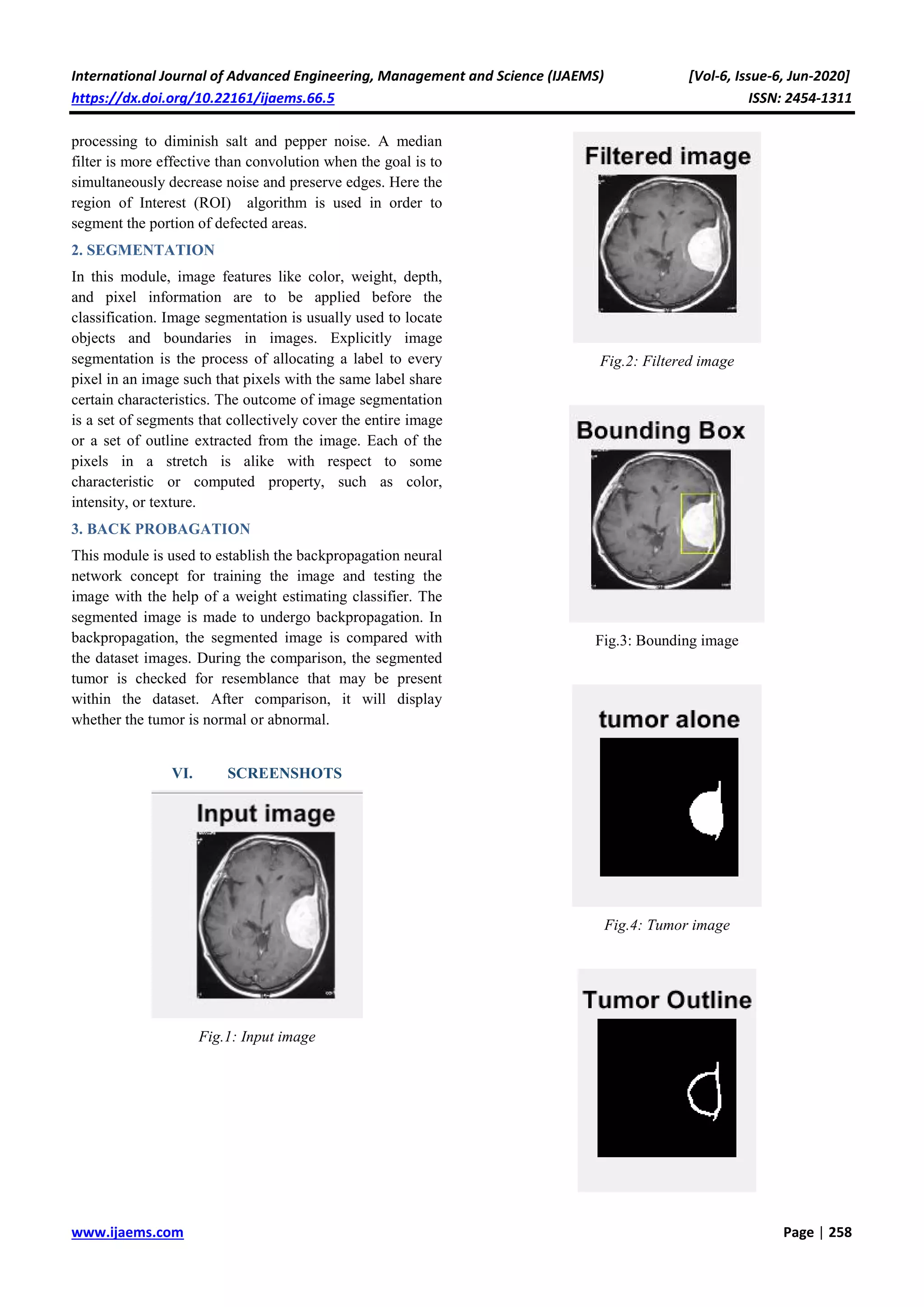 3D Segmentation of Brain Tumor Imaging | PDF
