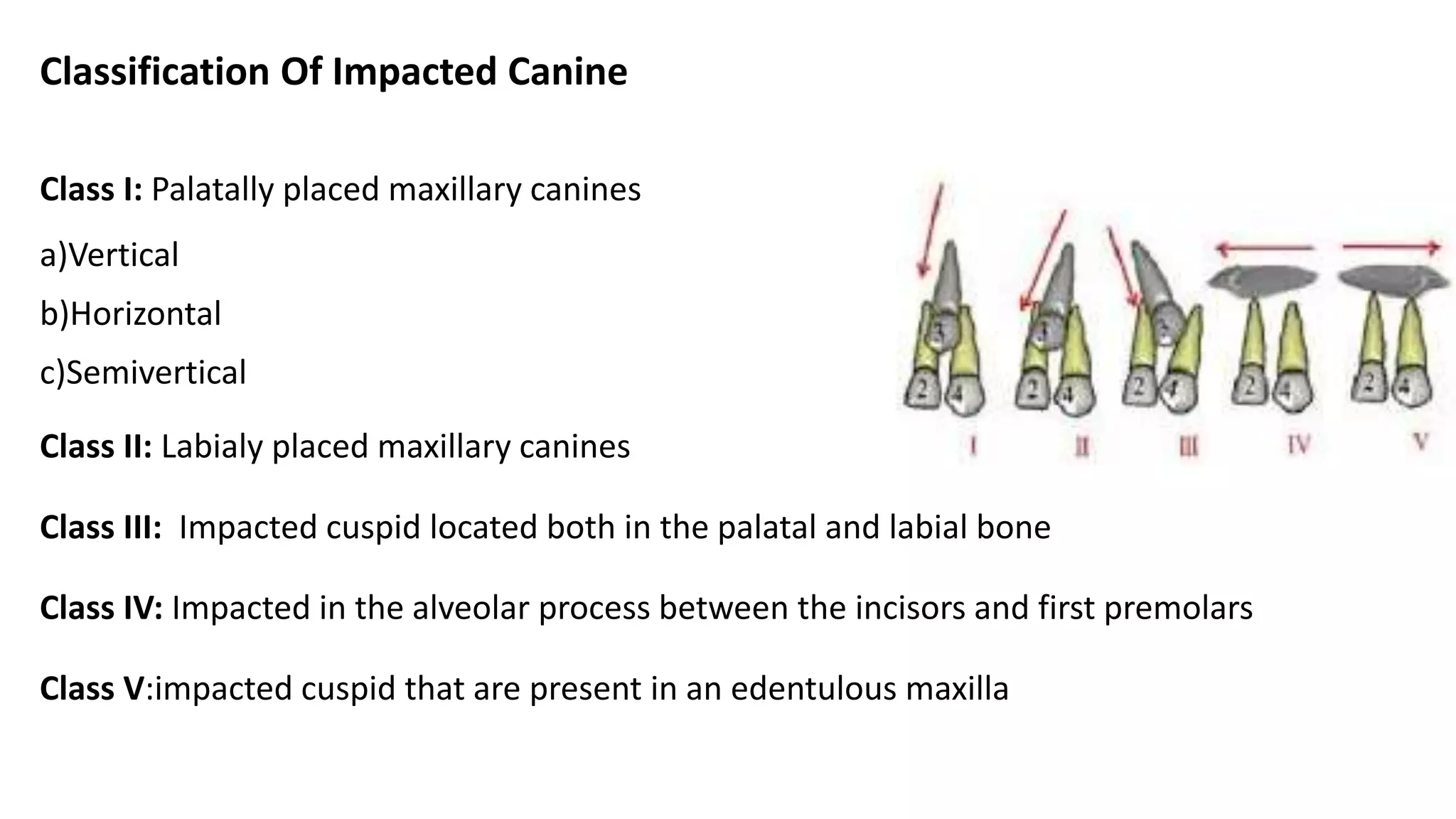 Impaction preoperative assessment.pptx