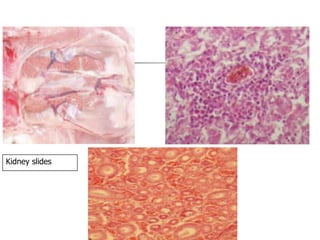 Infectious bronchitis (IB) is a highly contagious respiratory disease ...