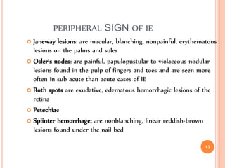 5 infective endocarditis | PPT